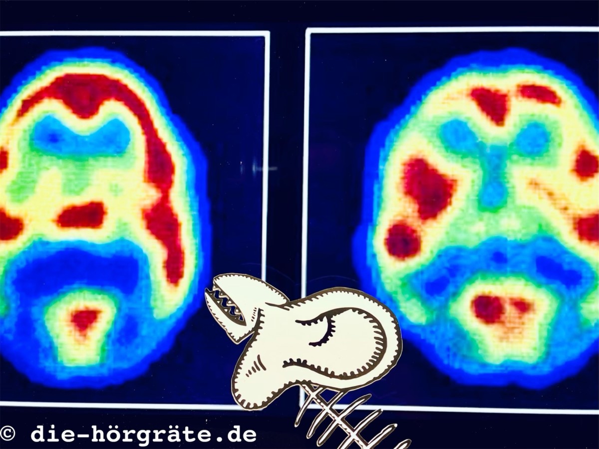Neuronen und Musik bzw. was unser Gehirn mit Musik macht